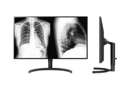 Monitor de Diagnóstico 31,5 polegadas 8 MP – FutureMed